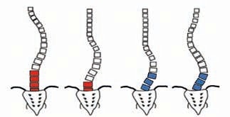 Biomechanik und Pathomechanik der lumbalen Wirbelsäule - Verlag ...