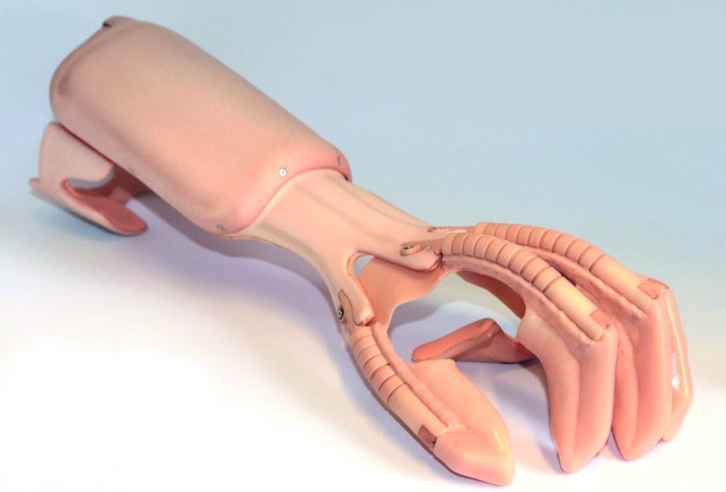 Exoskelett für Hände nach dem Lego-Prinzip - Orthopädie Technik