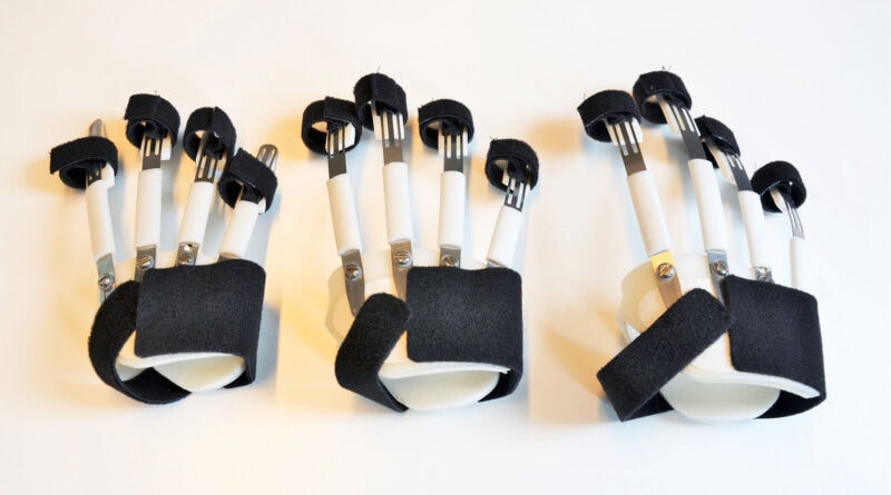 Entwicklung einer dynamischen Handorthese zur Behandlung einer ...